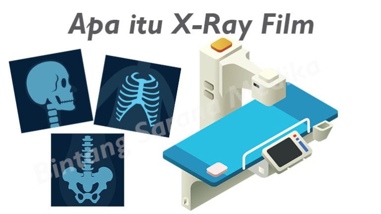 Apa Itu X-Ray Film - PT. Bintang Sarana Medika